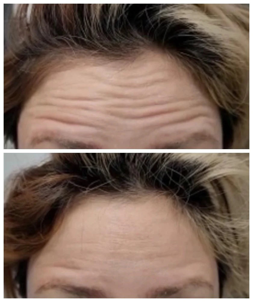 DEEP Wrinkle Remover